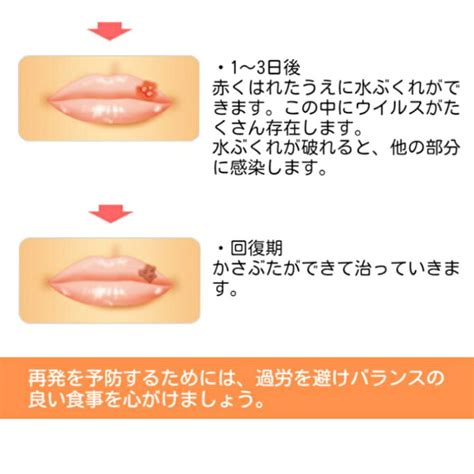 ヘルペシアクリーム 2g