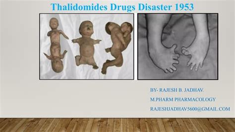 Thalidomide Drugs Disaster 1953 History Pptx