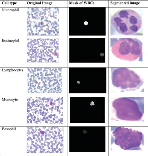 Segmentation Results With Sample Of Images Download Scientific Diagram