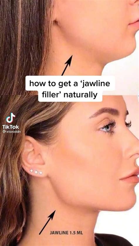 Purple Stretch Marks And What Actually Works To Fade Them Artofit