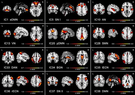 spatial distribution of 12 intrinsic resting state networks determined