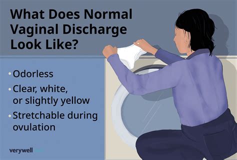Vaginal Discharge What Is Normal And Abnormal