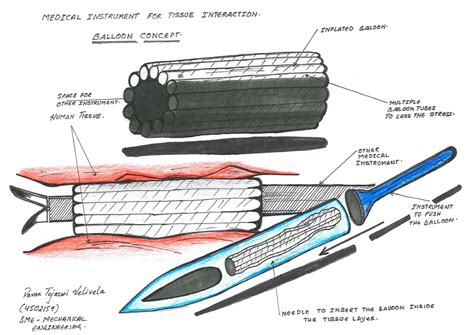 Schematic Figure Of The Balloon Concept Download Scientific Diagram