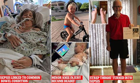 Sepsis Causes Signs Symptoms And Treatment Daily Mail Online