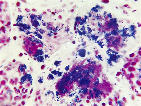 Gram Positive Vs Gram Negative Histology