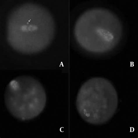 Different Human Oocyte Morphological Abnormalities Arrows Observed By Download Scientific
