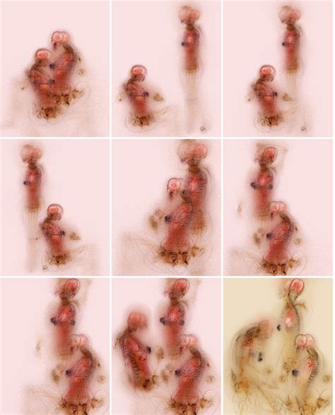 On Three Women And Two Layers Artists Blogs Medical Illustration Sourcebook