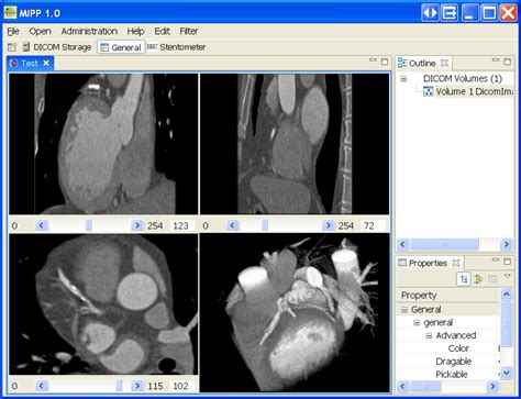 screenshot of mipp rcp general perspective download scientific diagram