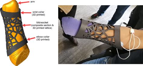 Construction Of The 3d Printed Socket Structure Download Scientific Diagram