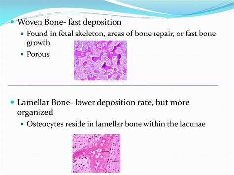 Woven Vs Lamellar Bone