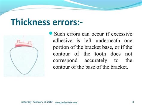 Mbt Bracket Placement PPT