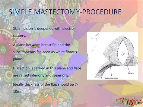 Mastectomy Pptx