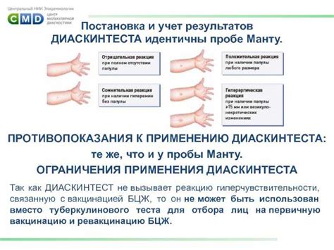 Диаскинтест