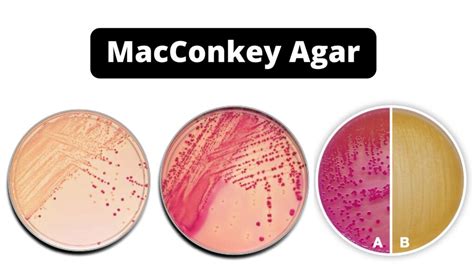 Pseudomonas Aeruginosa Colony Morphology On Macconkey Agar