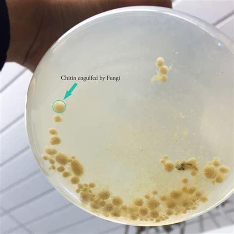 Globular Fungal Structure Engulfing Chitin Download Scientific Diagram