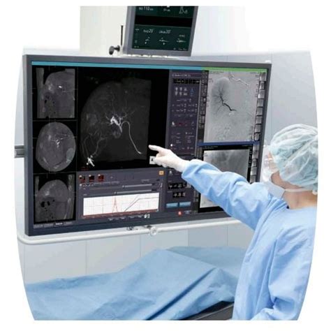 Shimadzu Trinias C16 Crossover Angiography System Unity Edition At