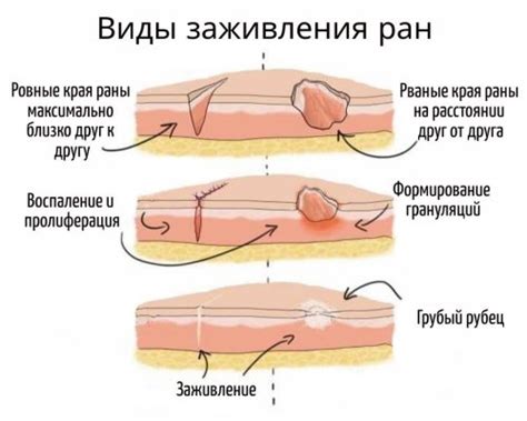 11 лучших ранозаживляющих мазей - Дерматология и венерология - Статьи ...