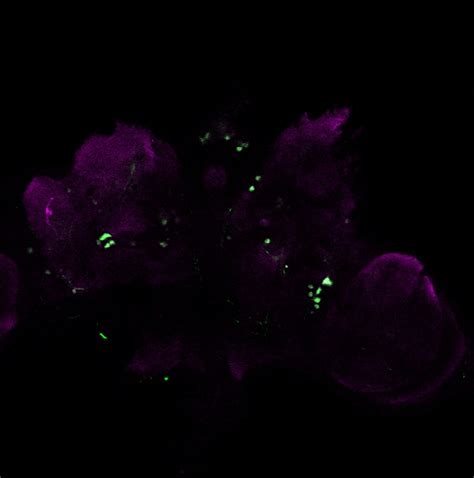 Antibody Staining W Th Gal4 Uas Gfp