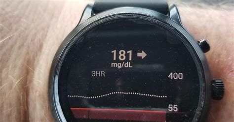 Dexcom Watchface Album On Imgur