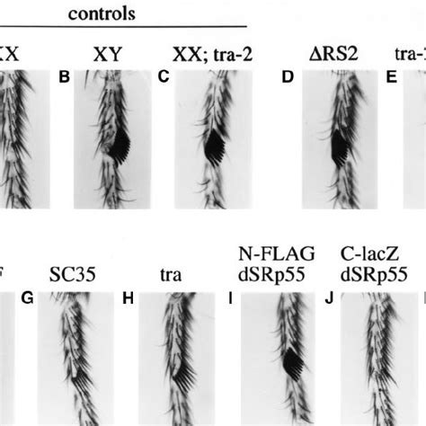 Differentiation Of Sex Combs In Transgenic Lines Male Sex Combs And Download Scientific