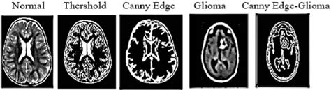 Canny Edge And Threshold Segmentation Download Scientific Diagram