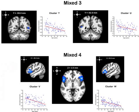 Clusters With Statistical Relationships To Age For Multi System Ie Download Scientific