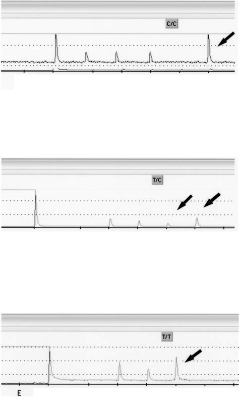 Pyrosequencing Analysis Of Dna From Colorectal Cancer Patients Download Scientific Diagram