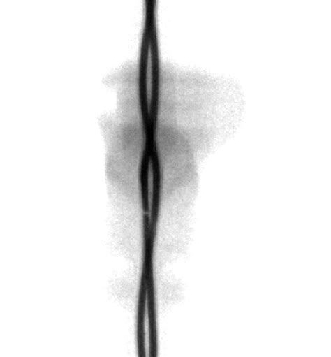 Image Crack Detection Opencv C Stack Overflow
