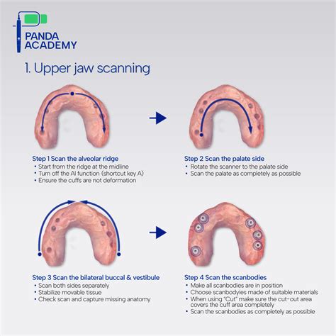 Digital Intraoral Scanning Technique For Edentulous Jaws At Ida