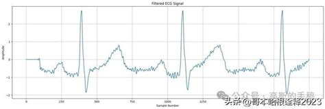 简单的基于信号处理的ecg信号降噪(python) 知乎 简单的基于信号处理的ecg信号降噪(python) 知乎