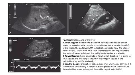 Hepatobiliary Imaging Pptx