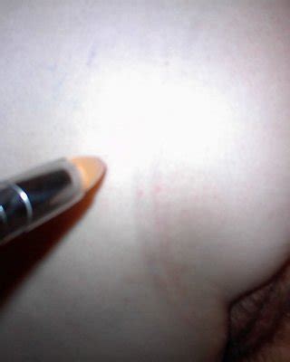 Enema And Scope Porn Pictures XXX Photos Sex Images PICTOA