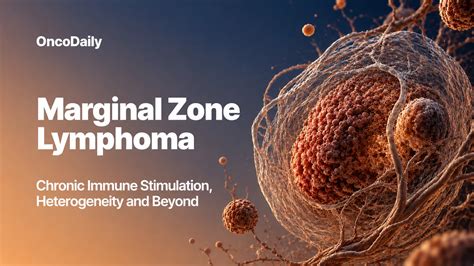 Marginal Zone Lymphoma Mzl Chronic Immune Stimulation Heterogeneity