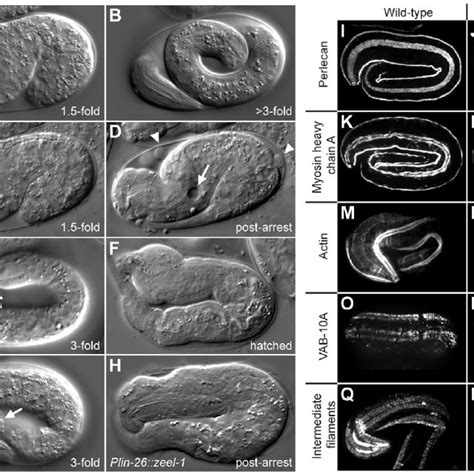 Peel 1 Localizes To Fibrous Body Membranous Organelles A Diagram Of