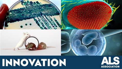 How The Als Association Speeds Innovation By Globally Funding Als