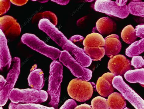 Streptococci Bacteria A Link Between Oral Bacteria And Elevated Stroke