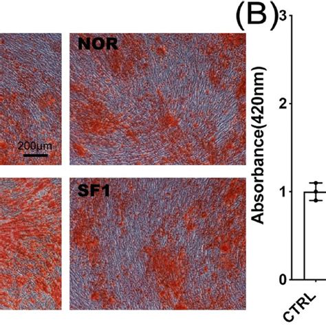 The Matrix Mineralization And Quantification Analysis After Osteogenic Download Scientific