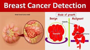 GitHub Poojayadav Breast Cancer Detection Using Machine Learning Classifier