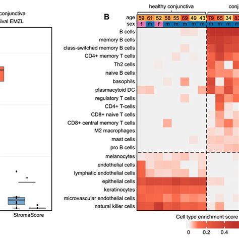Cell Type Deconvolution Analysis Provides New Insights Into The Tumor
