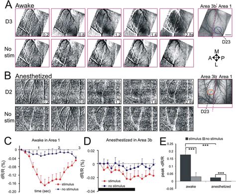 Temporal Development Of The Optical Signal In The Awake A And Download Scientific Diagram