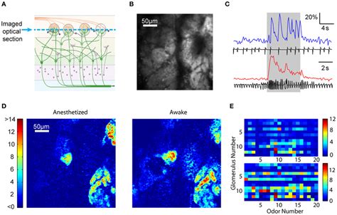 Multi Photon Optical Sectioning Confirms The Consistency Of Glomerular