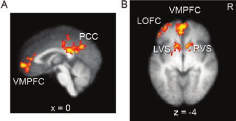 Brain Regions Sensitive To Experienced Risk The Risk Is Determined By