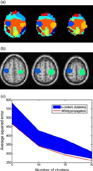 Results For The Real Fmri Test Of The Hand Movement Block Design