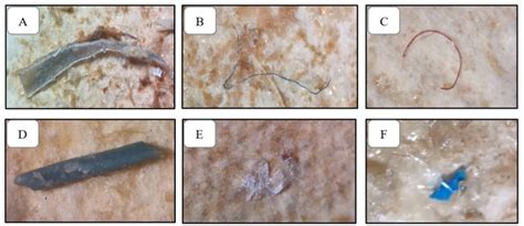 Photographs Of Some Of The Microplastics Retrieved From The Gut