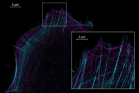 Extended Live Cell Imaging At Nanoscale Resolution Learn And Share Leica Microsystems