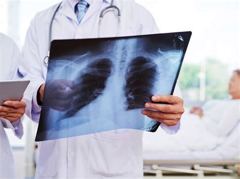 PPD Skin Test Tuberculosis Test