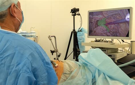 Laparoscopic Fluorescence Imaging Enhancing Surgical Visualization And Assessment