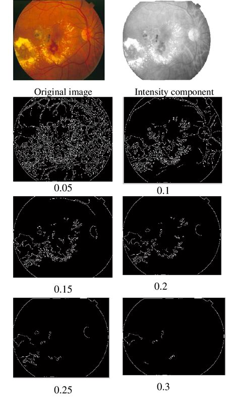 canny edge detector to obtain the edges of the retina image using 6