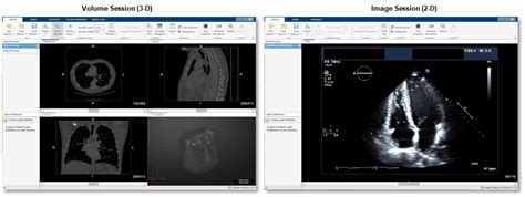 get started with medical image labeler