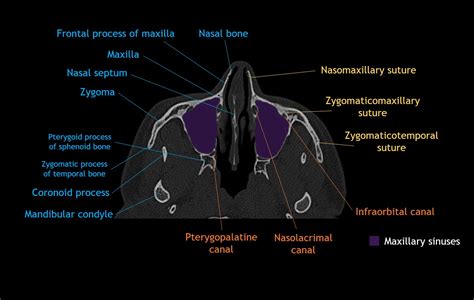 Axial Ct Scan Of Face Surface Landmarks